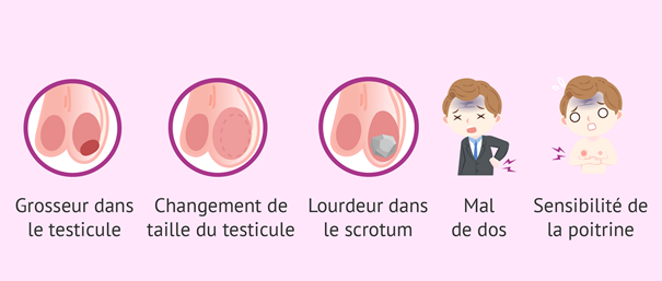 Quiz Cancers Masculins - fin • Cancer Environnement